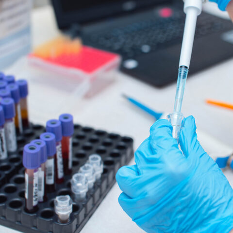 Le bilan martial - Blog Santé Ketterthill